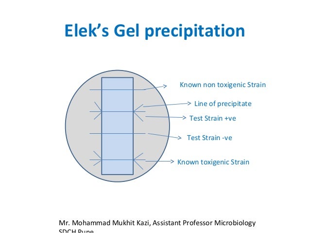 How to preapre av aids