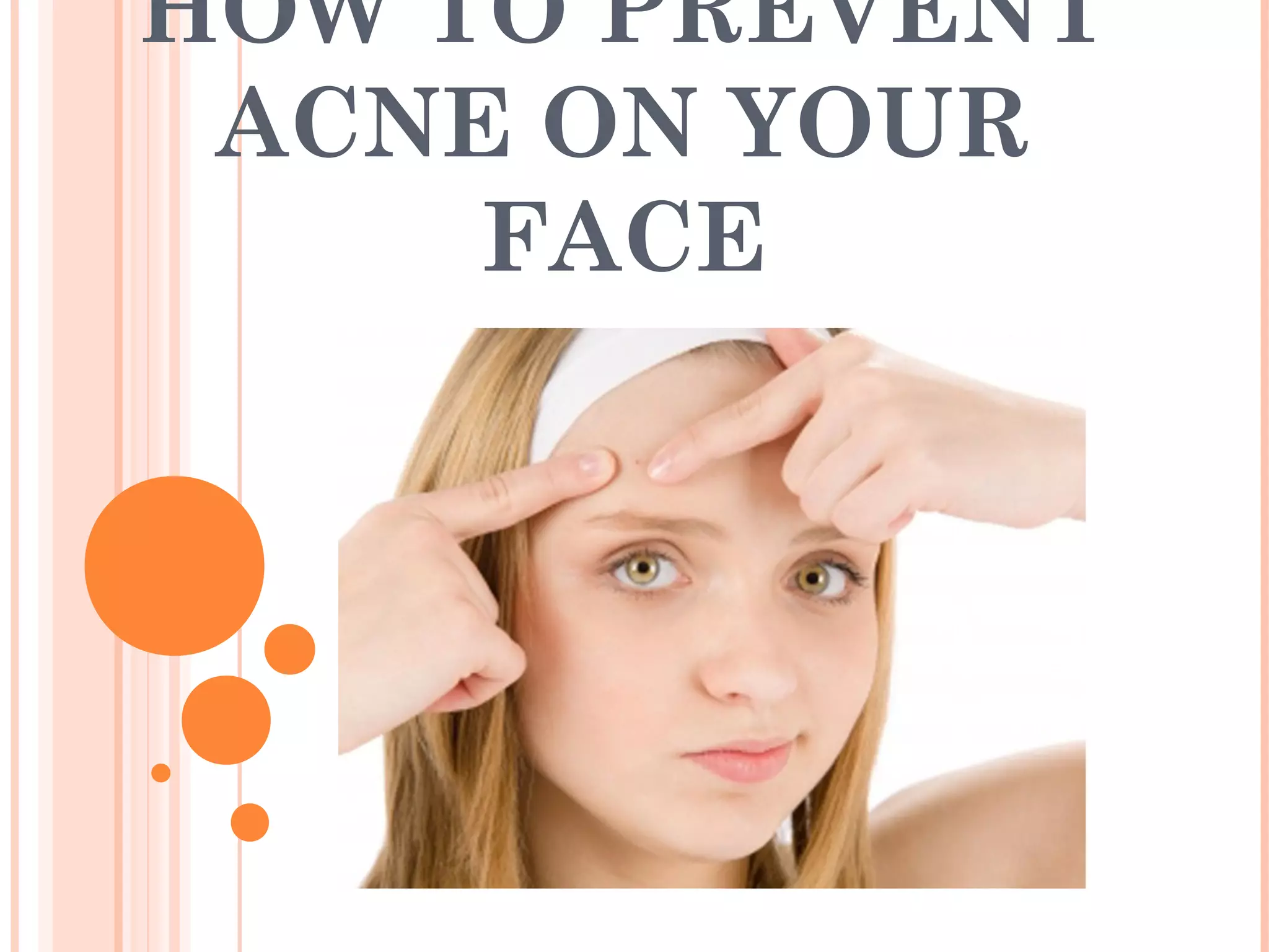 How to prevent acne on your face | PPT