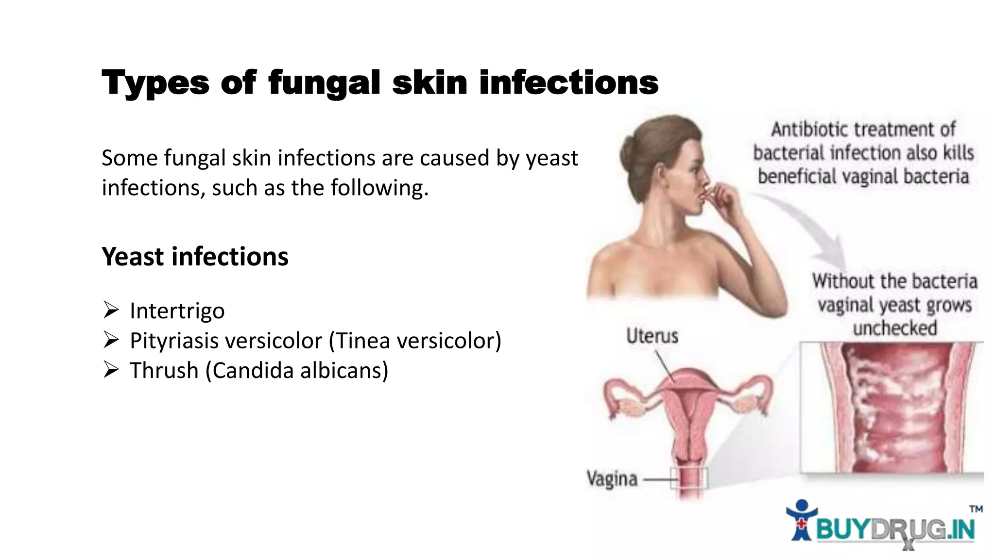How to prevent fungal skin infections | PPTX