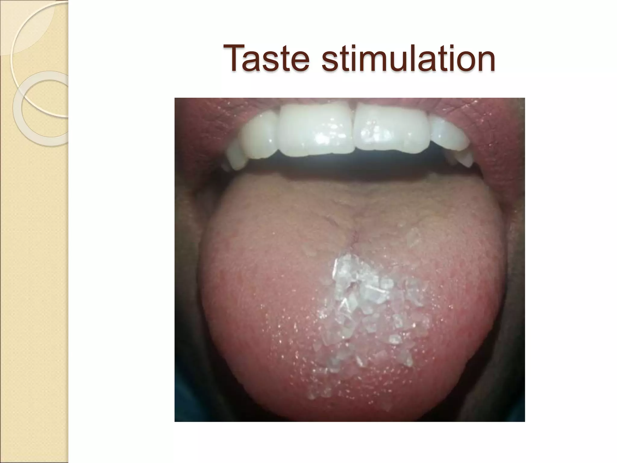 How to Prevent Lingual nerve Damage during Mandibular 1.ppt