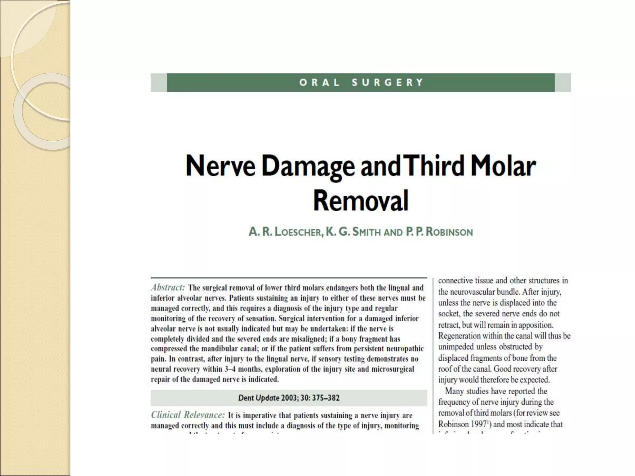 How to Prevent Lingual nerve Damage during Mandibular 1.ppt