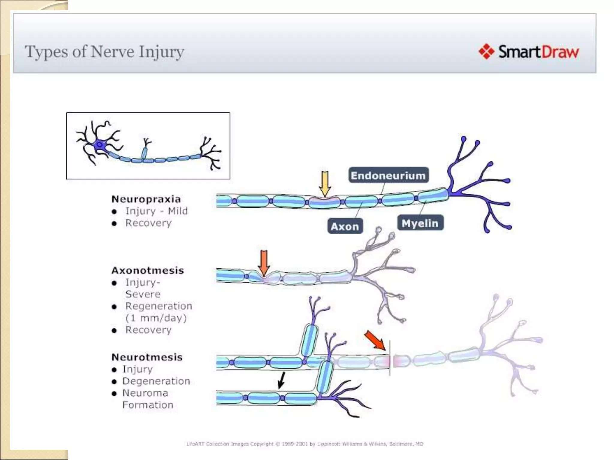 How to Prevent Lingual nerve Damage during Mandibular 1.ppt