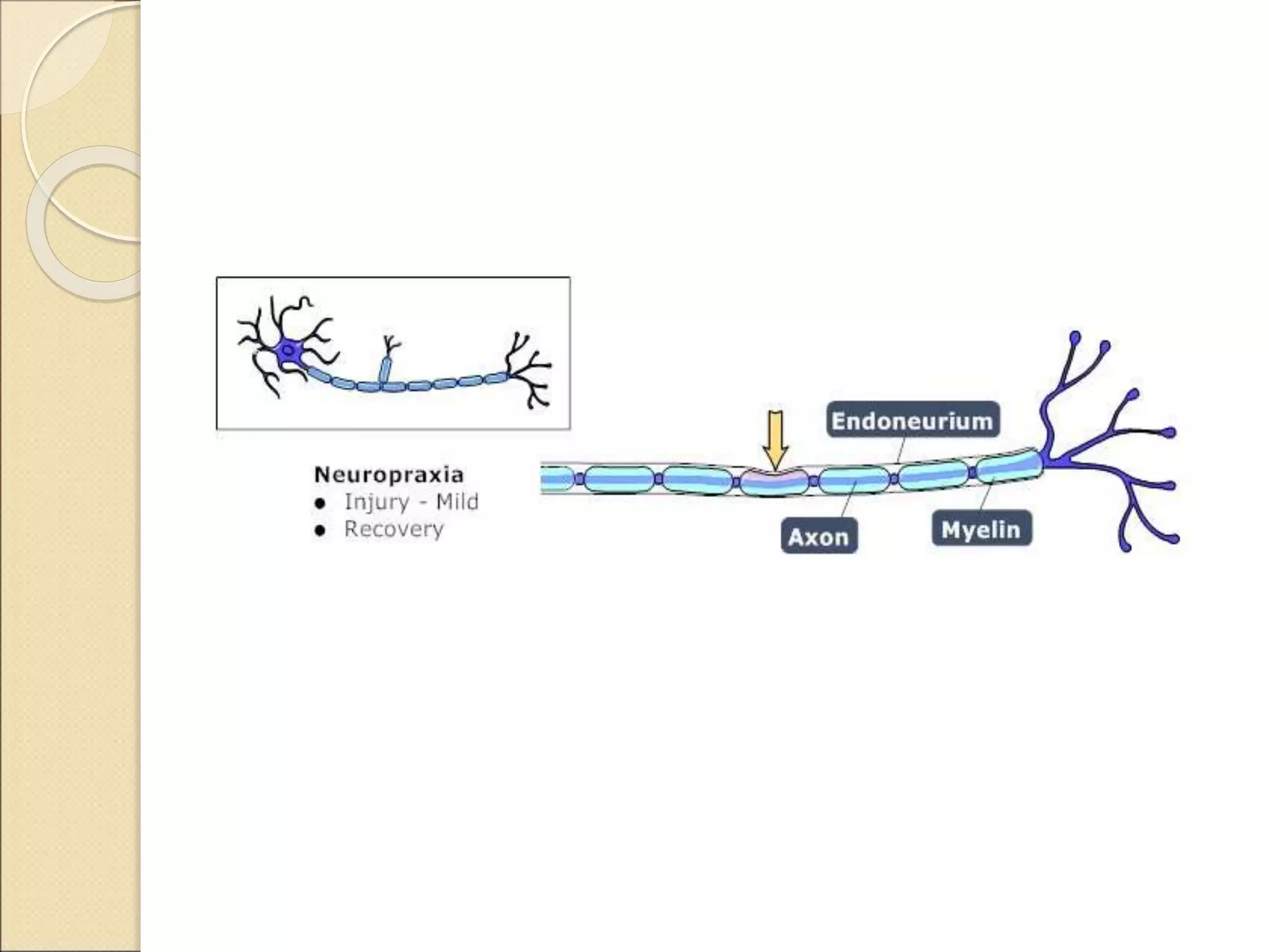 How to Prevent Lingual nerve Damage during Mandibular 1.ppt