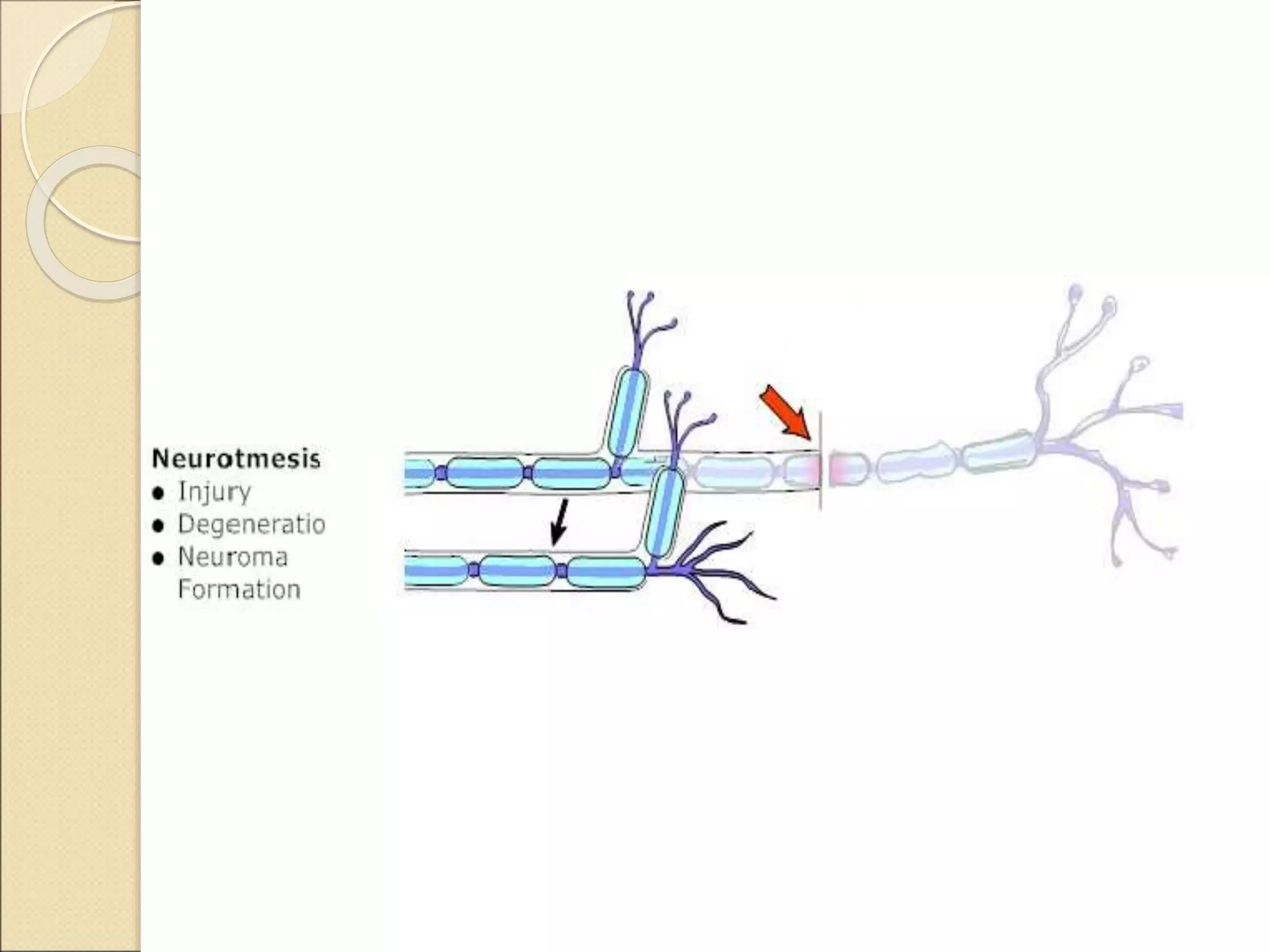 How to Prevent Lingual nerve Damage during Mandibular 1.ppt