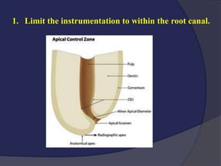 How to prevent post instrumentation pain | PPTX