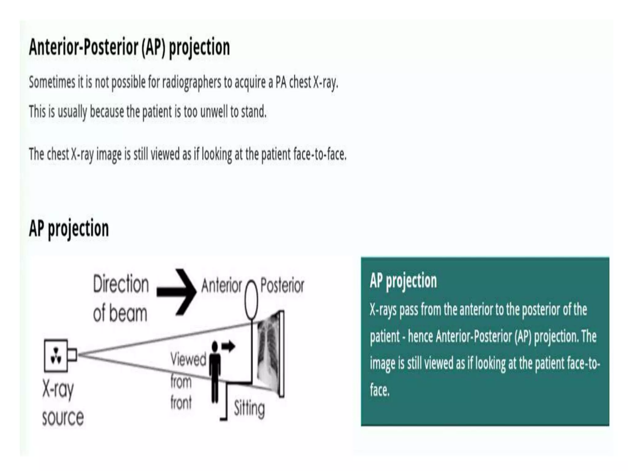 How to read a Chest X Ray film (Radiograph).pptx