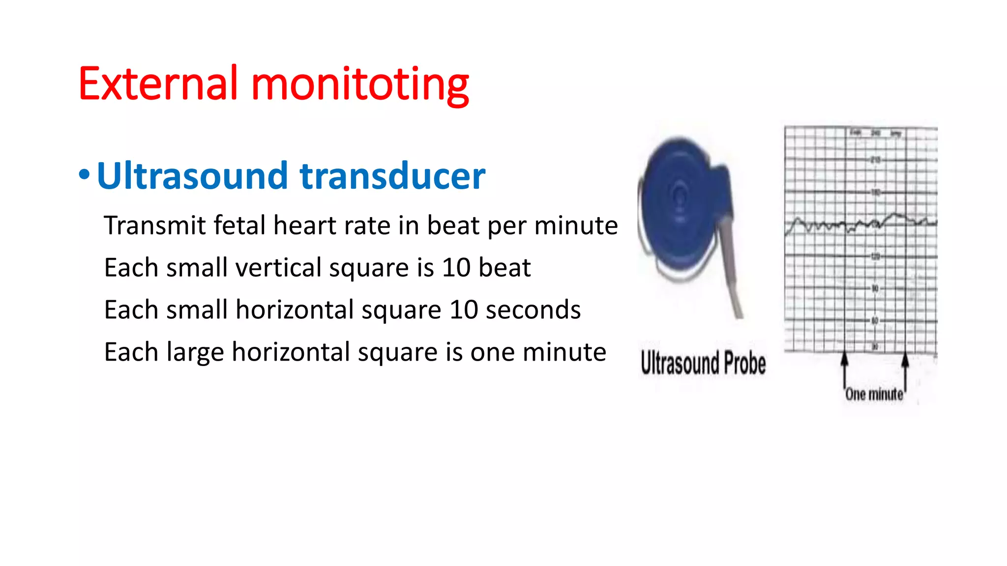 How to read a CTG دكتور صلاح رزق.pptx