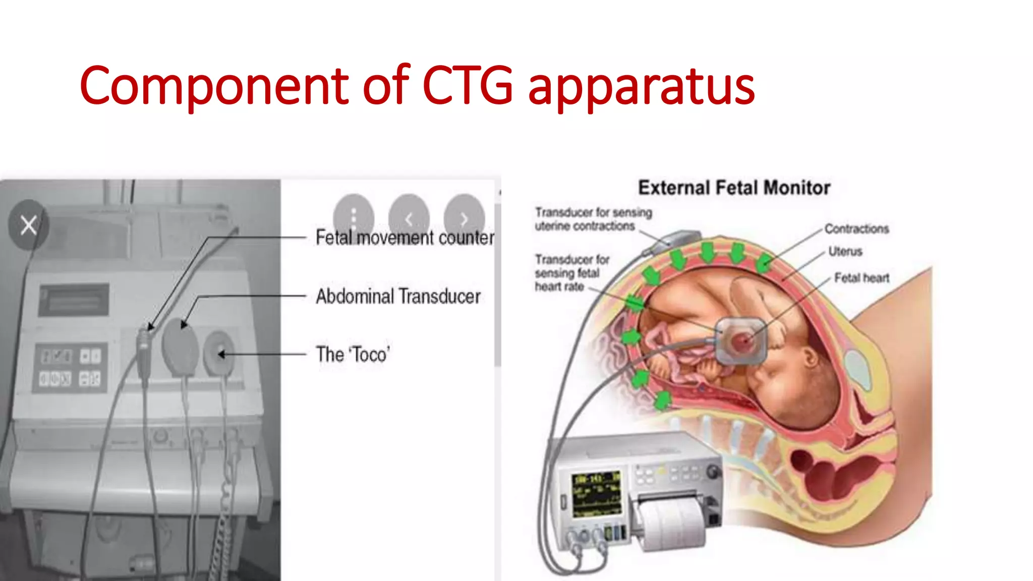 How to read a CTG دكتور صلاح رزق.pptx