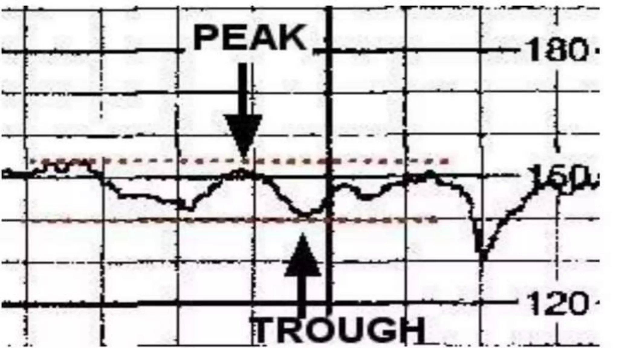 How to read a CTG دكتور صلاح رزق.pptx