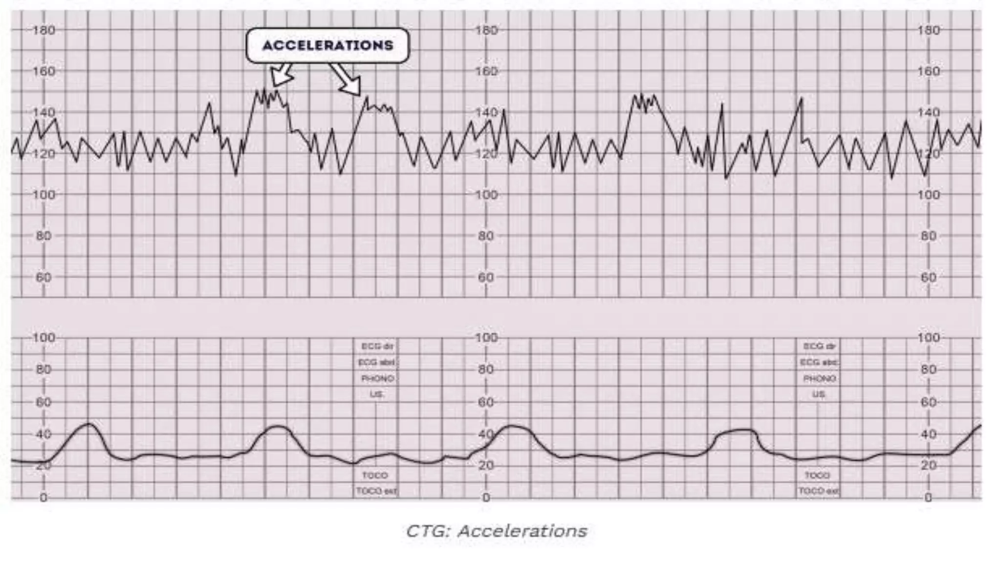 How to read a CTG دكتور صلاح رزق.pptx