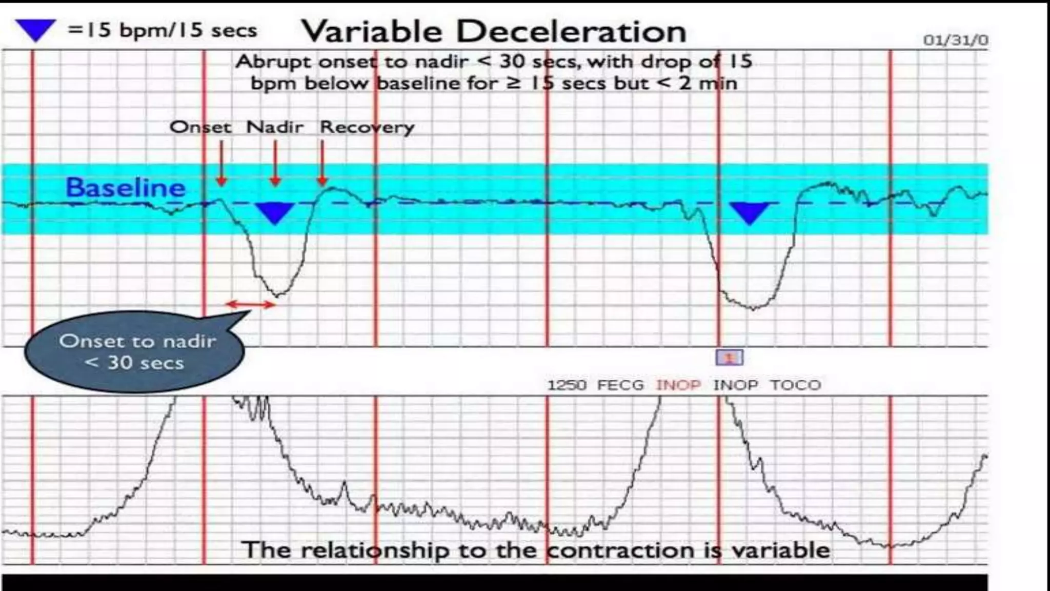 How to read a CTG دكتور صلاح رزق.pptx