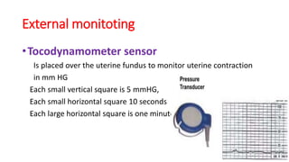 How to read a CTG دكتور صلاح رزق.pptx