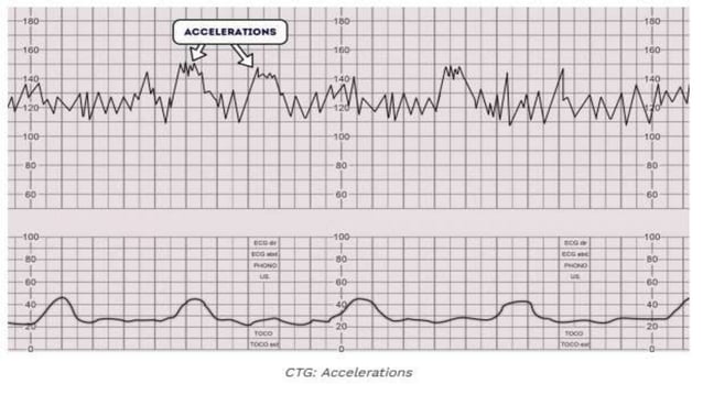 How to read a CTG دكتور صلاح رزق.pptx