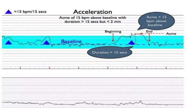 How to read a CTG دكتور صلاح رزق.pptx