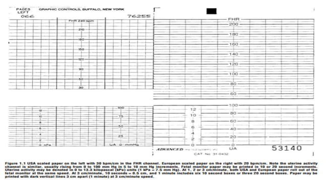 How to read a CTG دكتور صلاح رزق.pptx