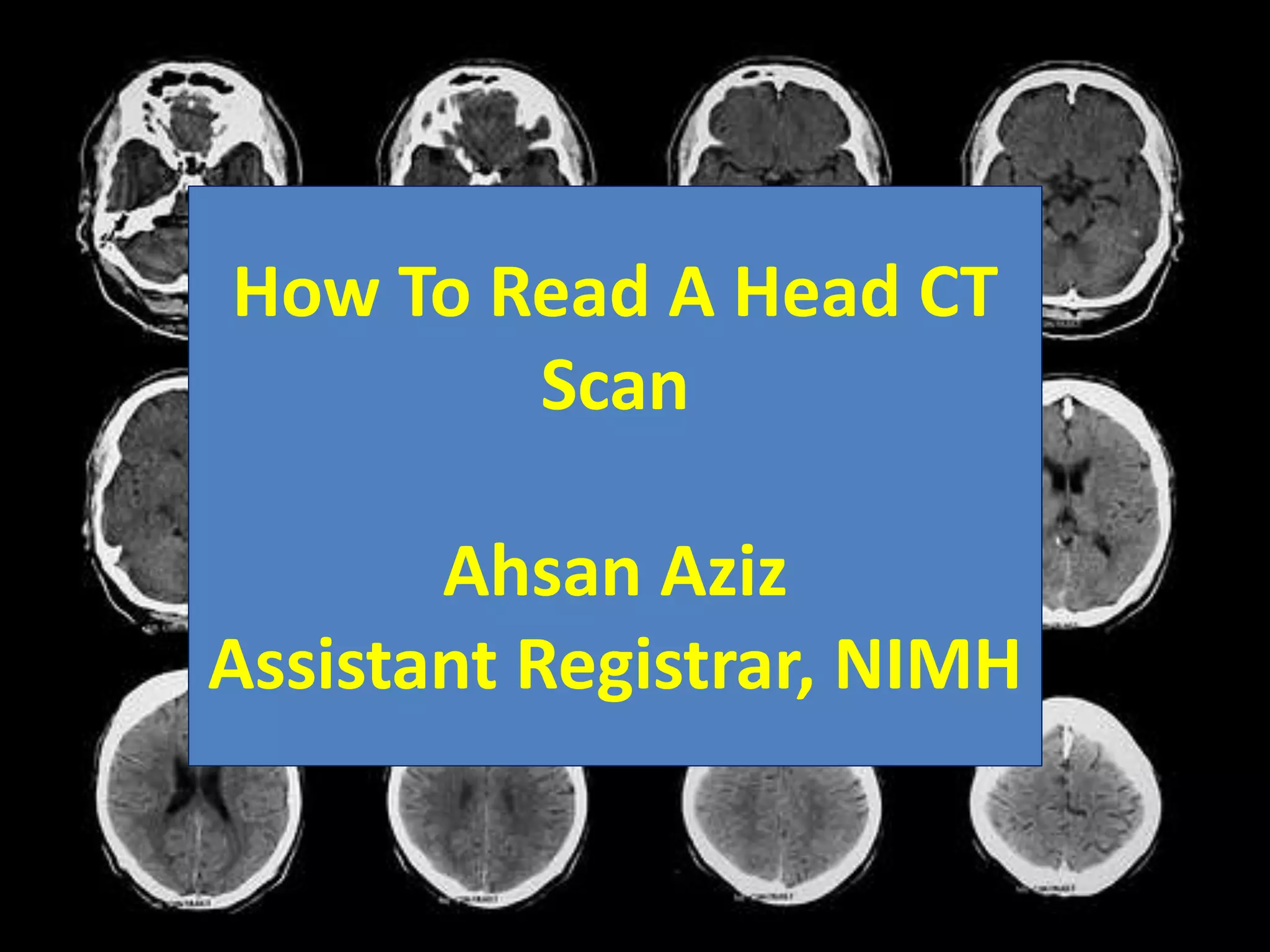 How To Read A Head CT Scan | PPTX