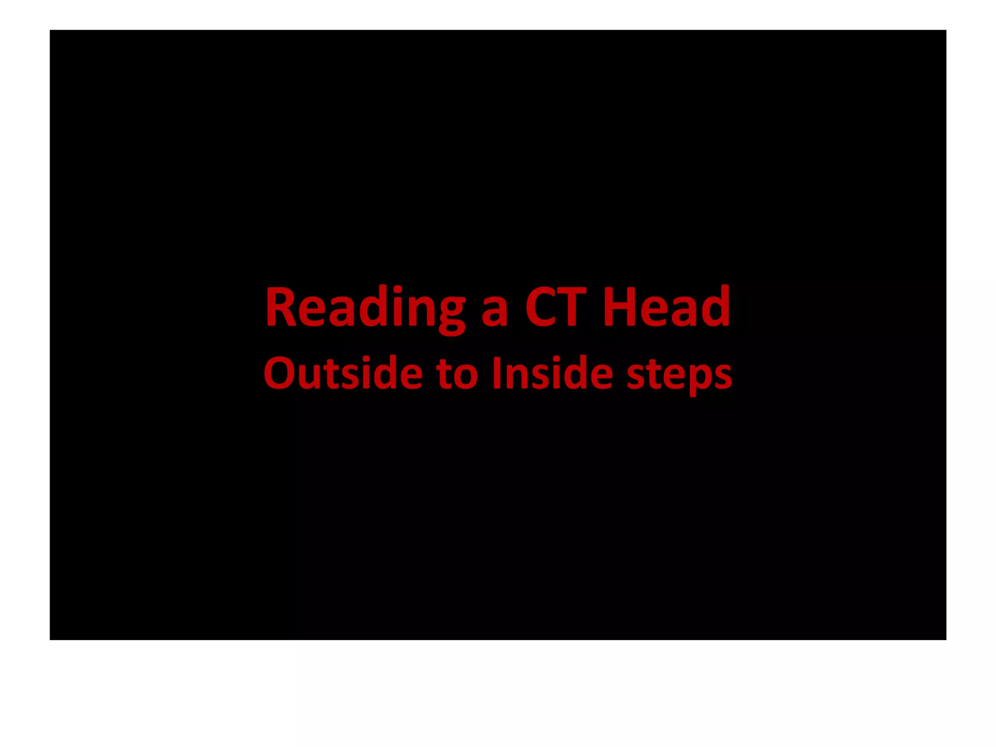 How To Read A Head CT Scan | PPTX