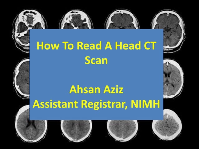 How To Read A Head CT Scan | PPTX