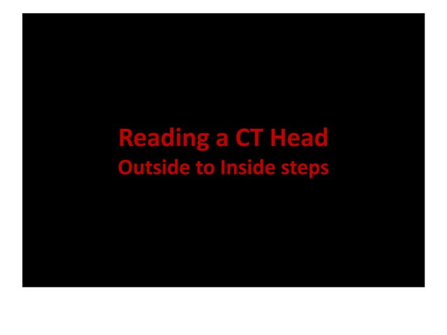 How To Read A Head CT Scan | PPTX