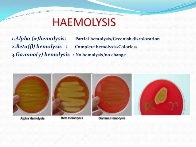How to read a culture plate