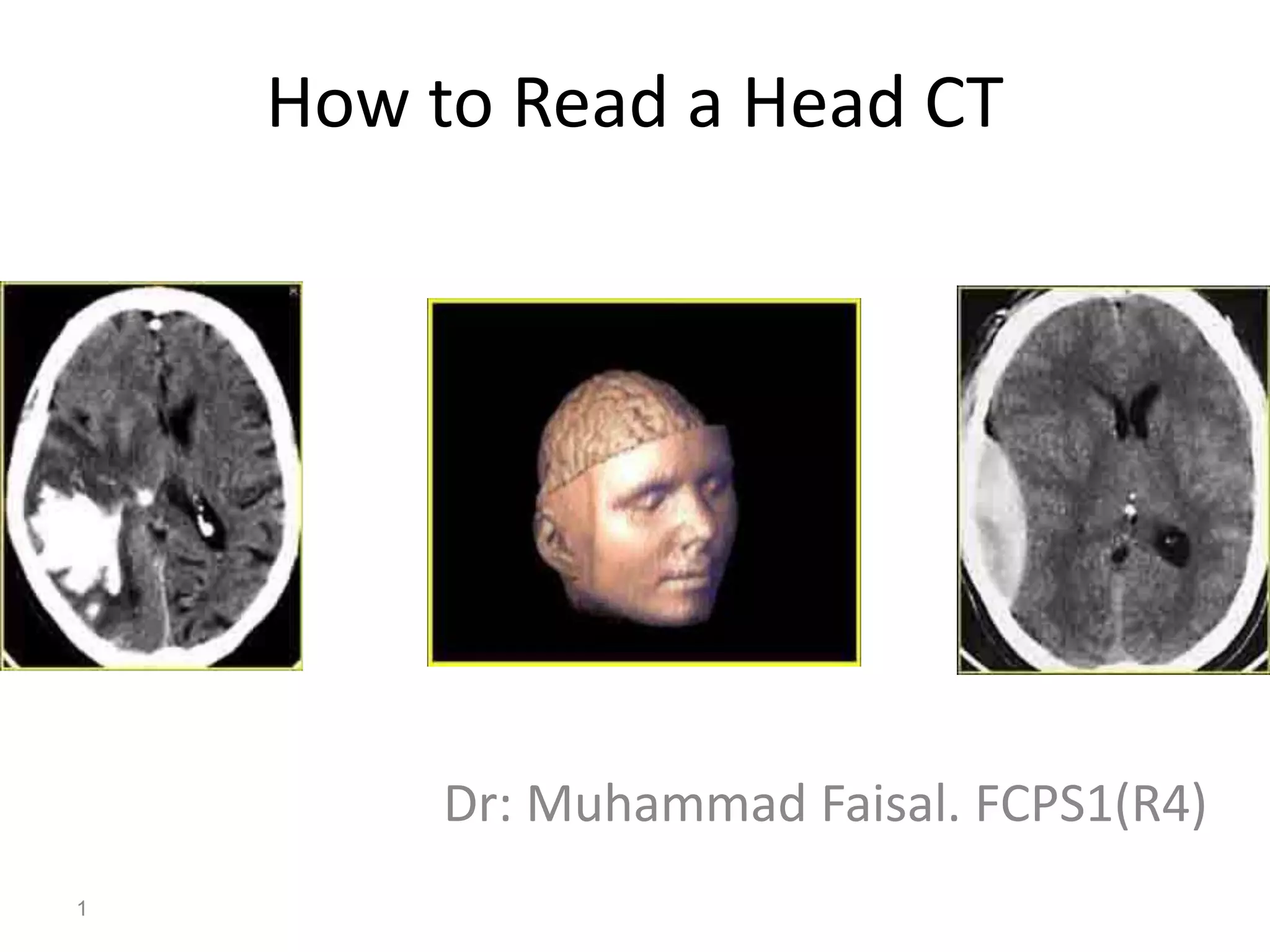 How to Read a Head CT.pptx