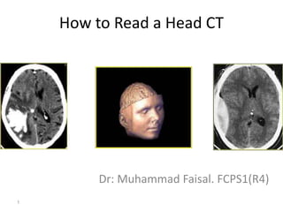 How to Read a Head CT.pptx