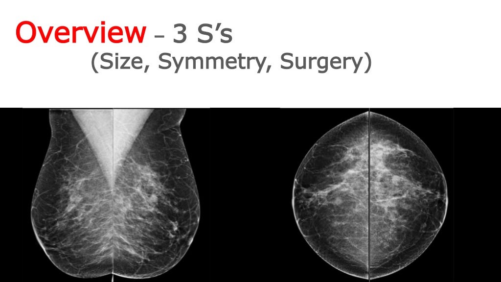 How To Read A Mammogram