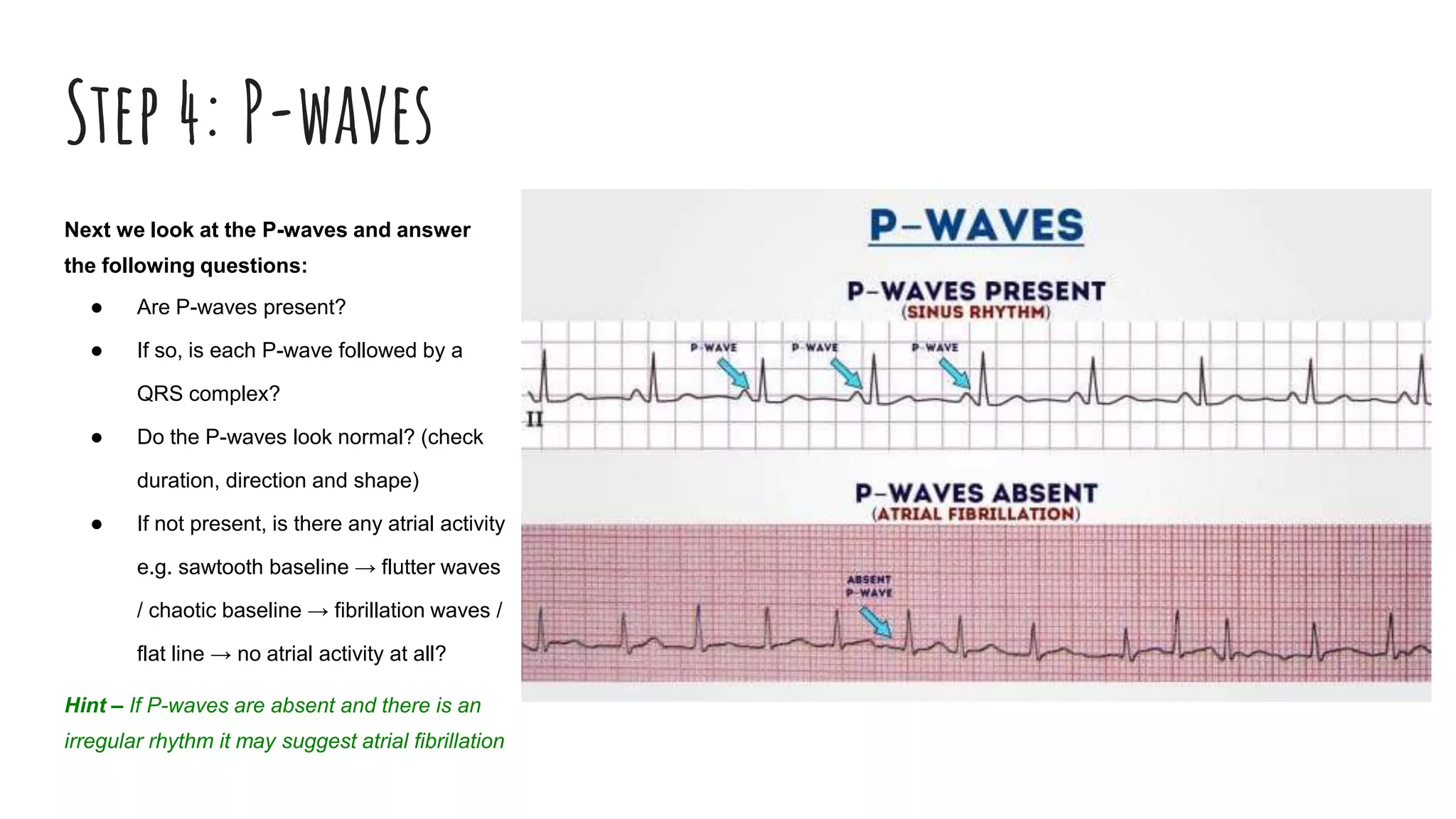 How to read an ecg | PPTX