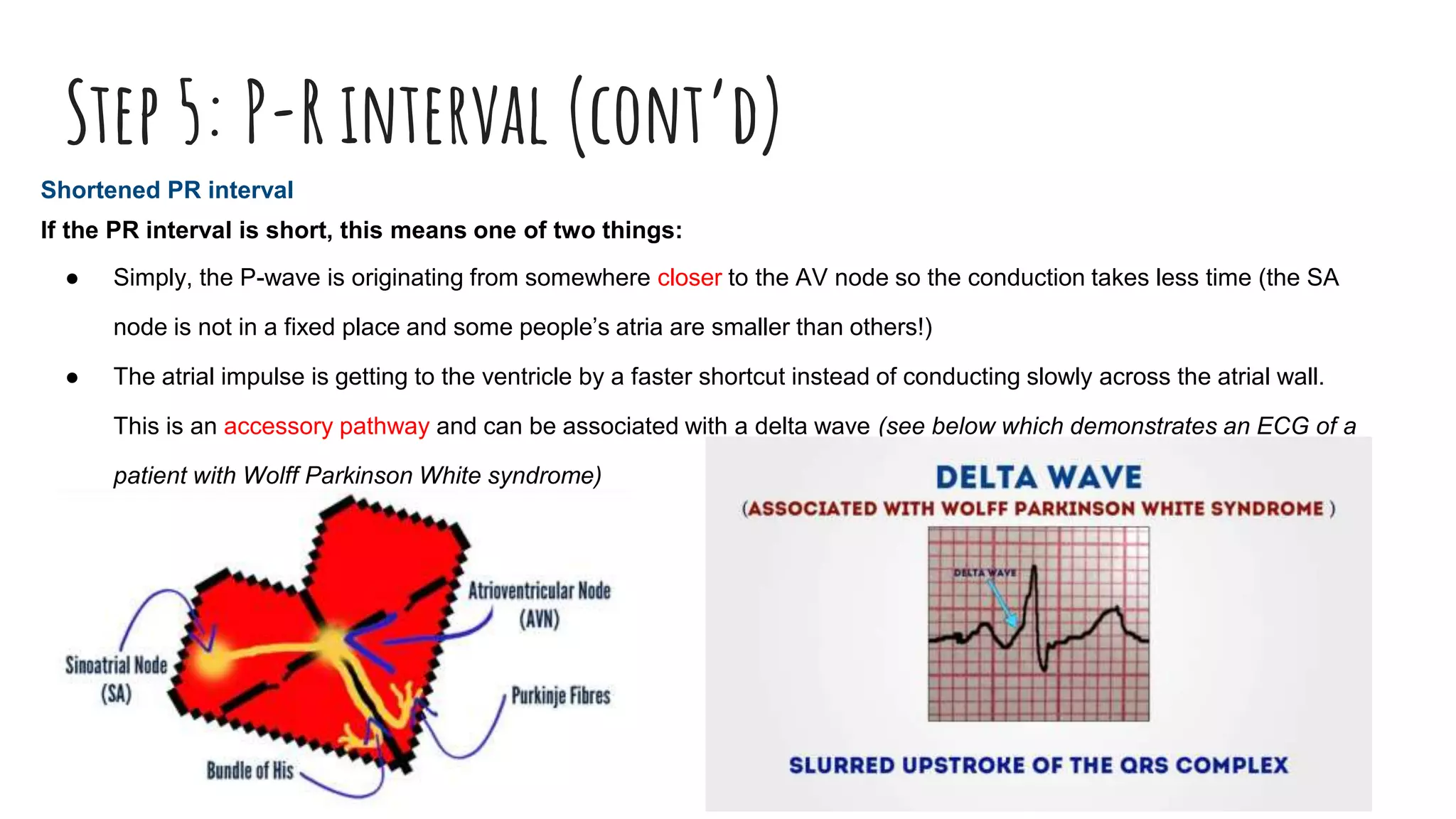 How to read an ecg | PPTX