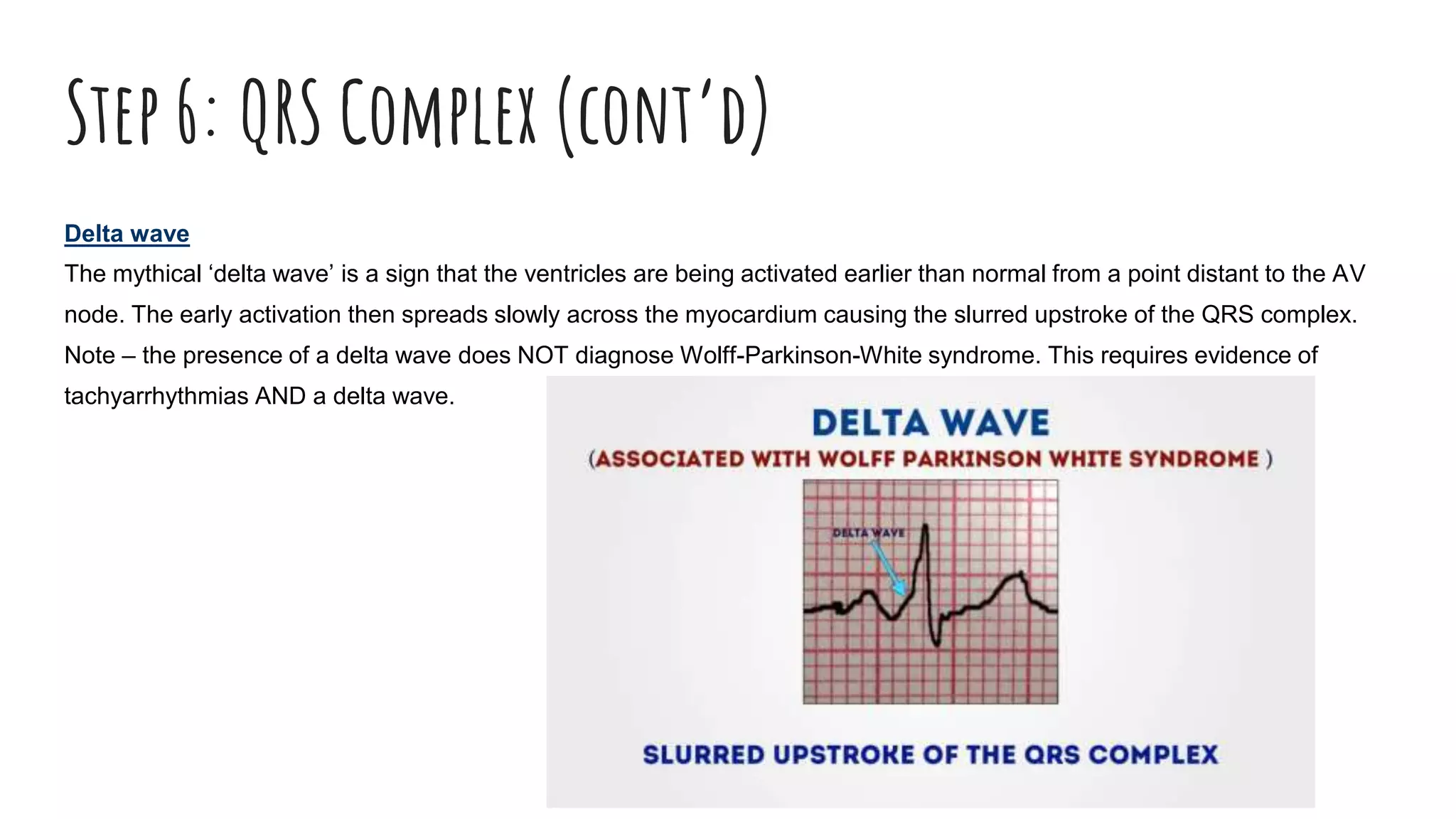 How to read an ecg | PPTX