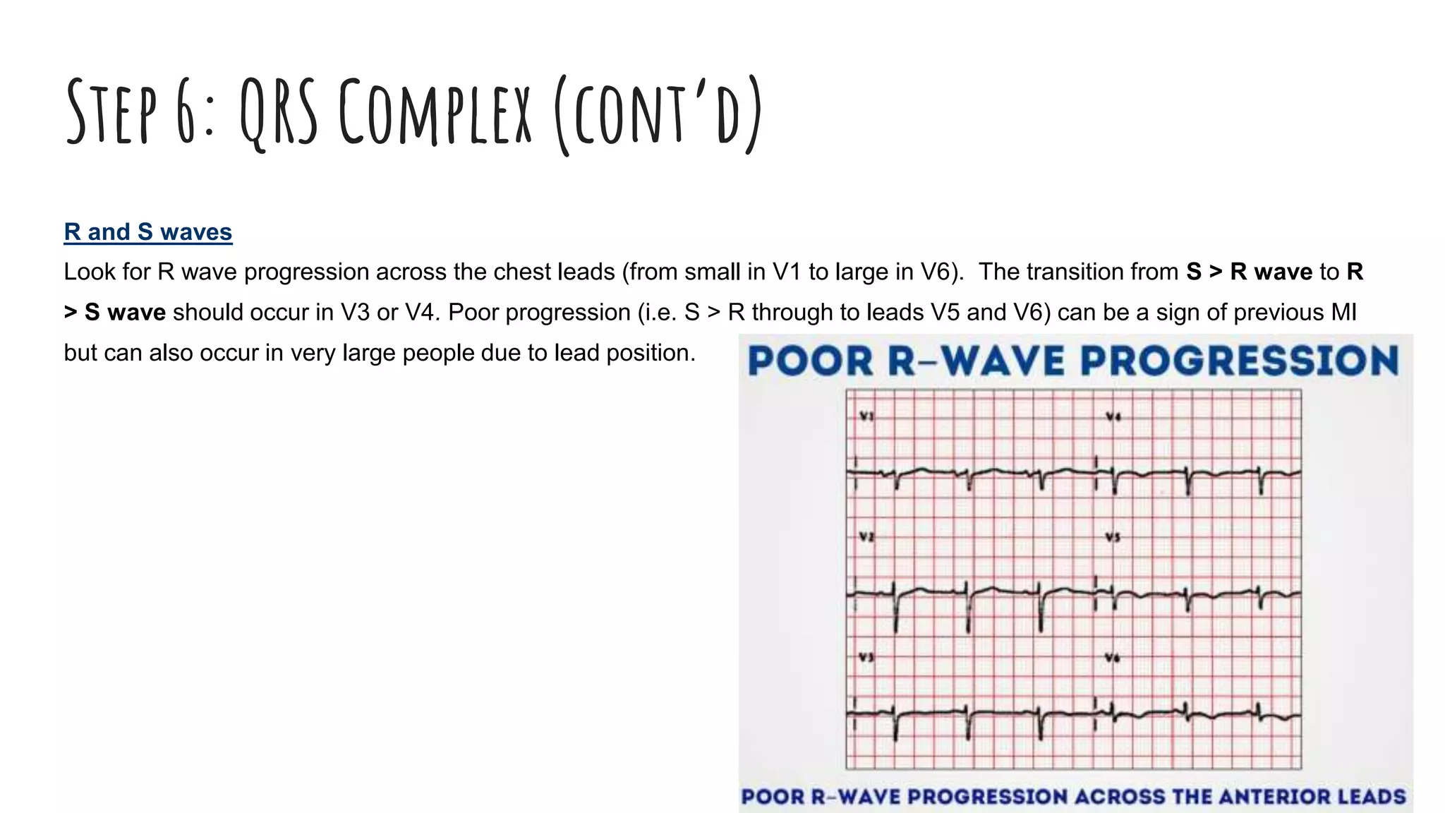 How to read an ecg | PPTX