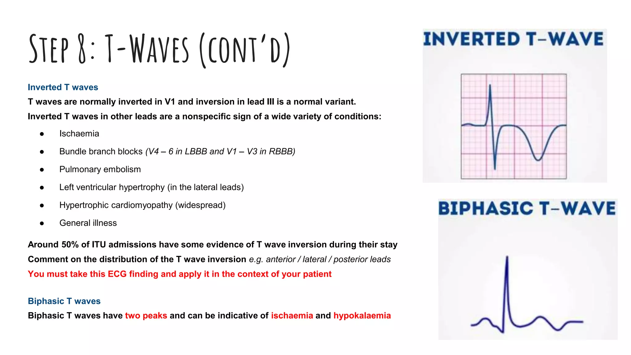How to read an ecg | PPTX