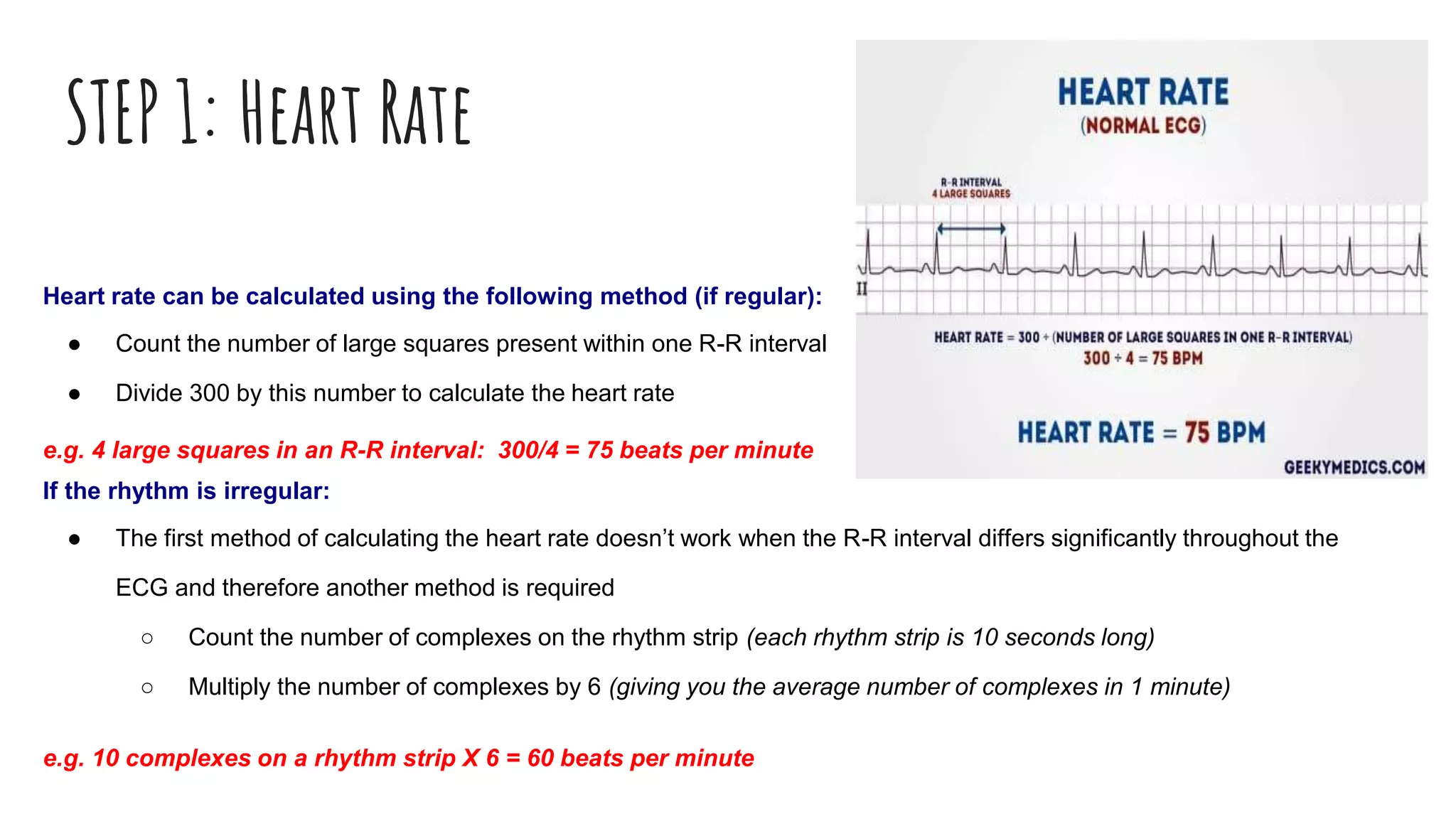 How to read an ecg | PPTX