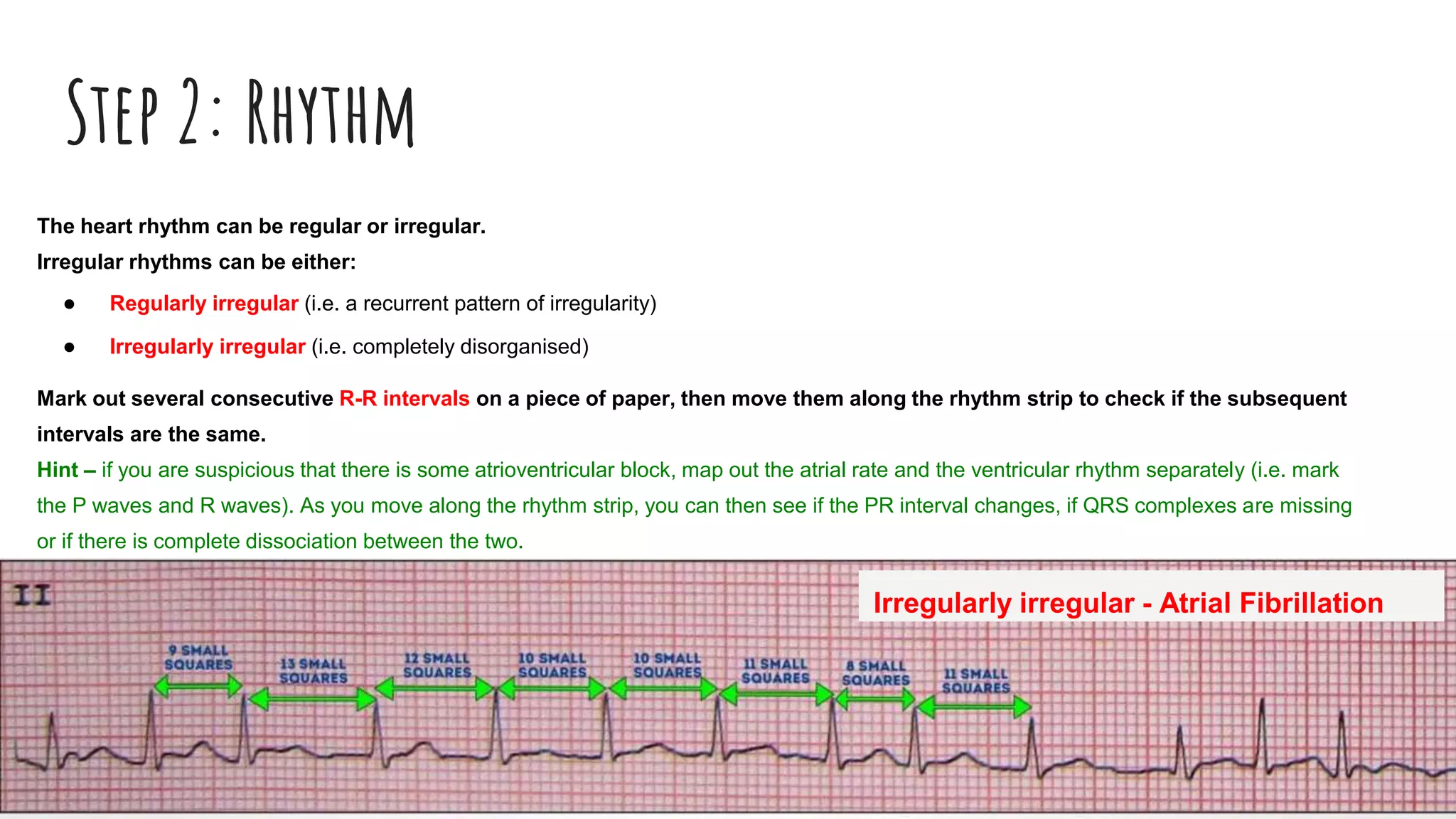 How to read an ecg | PPTX