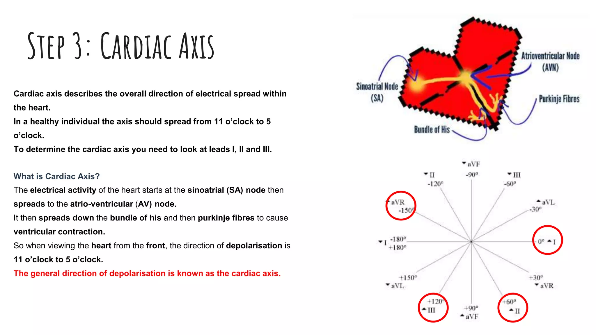 How to read an ecg | PPTX