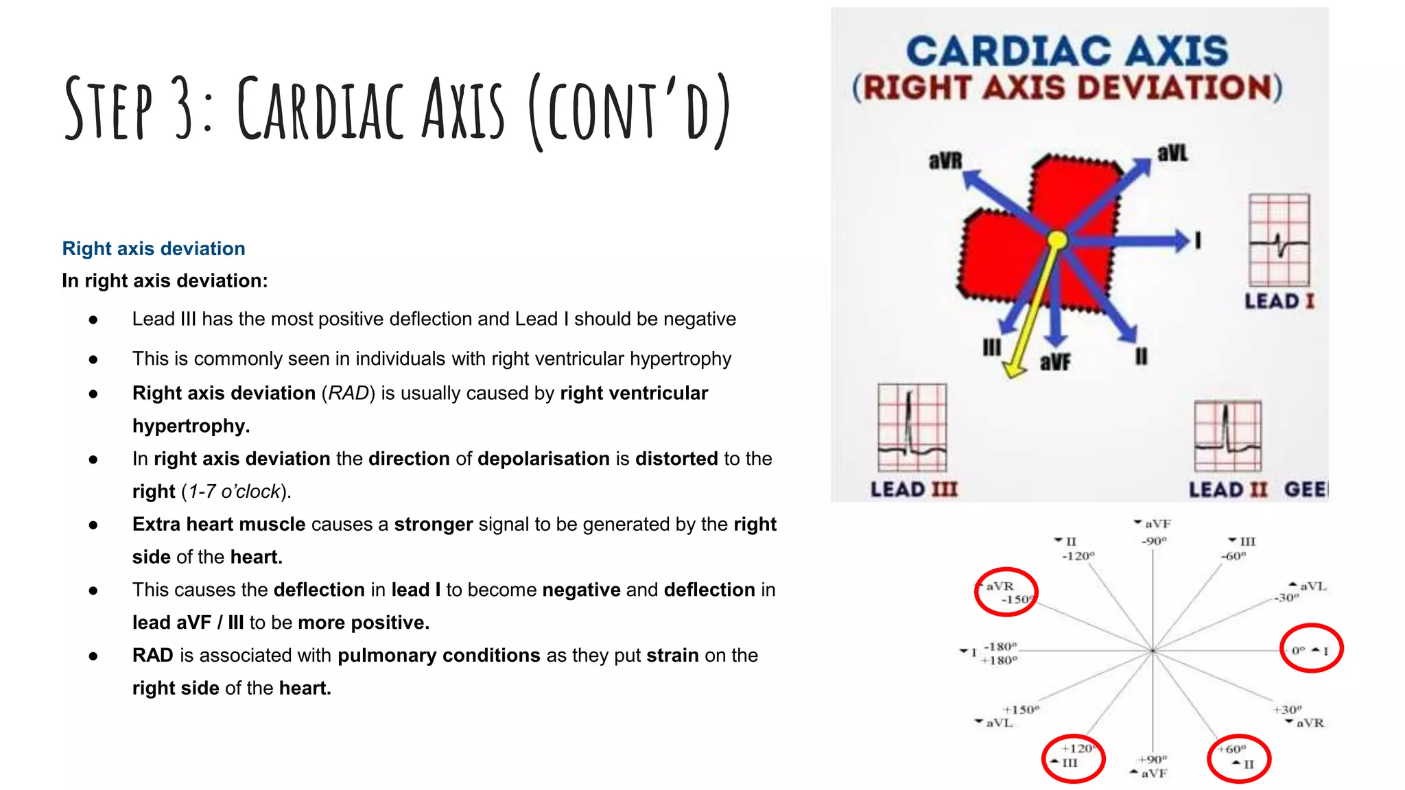 How to read an ecg | PPTX