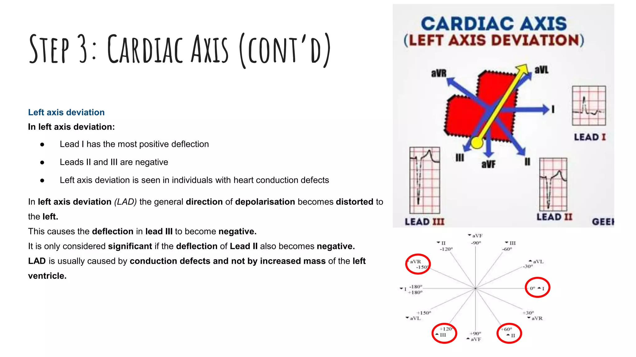 How to read an ecg | PPTX