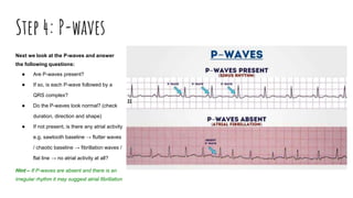 How to read an ecg | PPTX