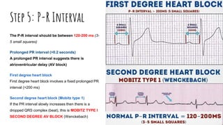 How to read an ecg | PPTX