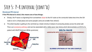 How to read an ecg | PPTX