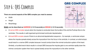 How to read an ecg | PPTX