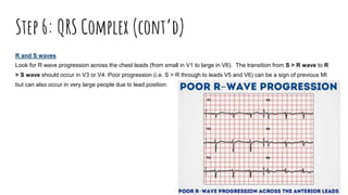 How to read an ecg | PPTX
