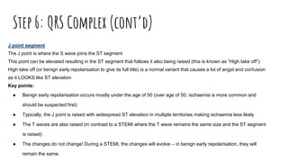 How to read an ecg | PPTX