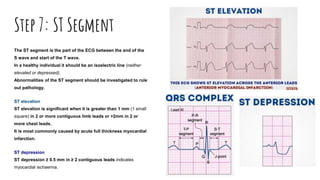 How to read an ecg | PPTX