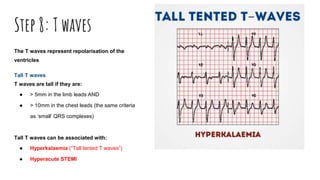 How to read an ecg | PPTX