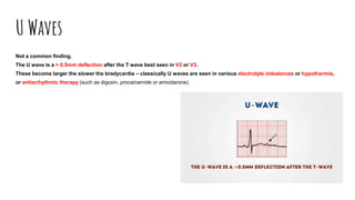 How to read an ecg | PPTX