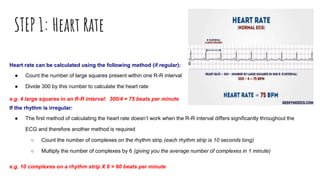 How to read an ecg | PPTX