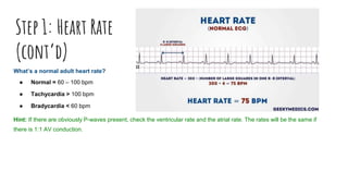 How to read an ecg | PPTX