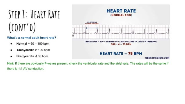 How to read an ecg | PPTX | Heart and Cardiovascular Diseases ...