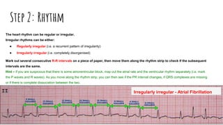 How to read an ecg | PPTX